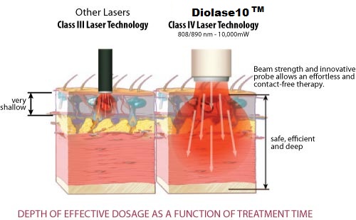 Class Iv Laser | Laser Therapy